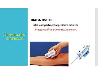 Long bone fracture complication | PPTX