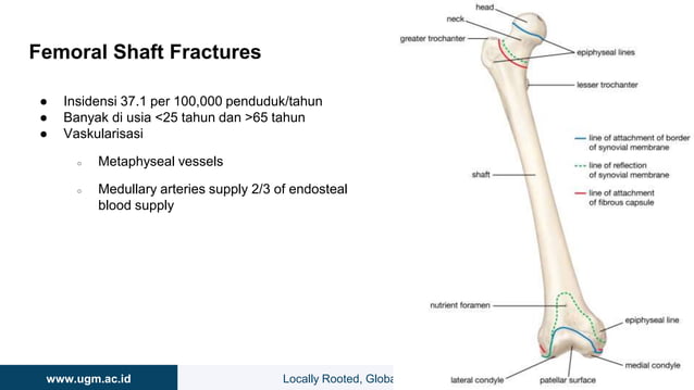 Long Bone Fractures - DEA (1).pptx