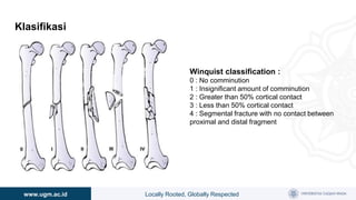 Long Bone Fractures - DEA (1).pptx
