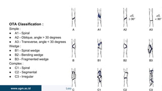 Long Bone Fractures - DEA (1).pptx