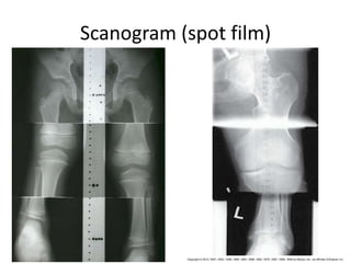Long bone measurement | PPT