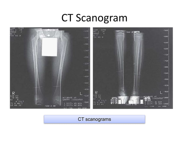 Long bone measurement | PPT