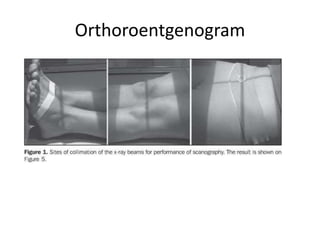 Long bone measurement | PPT