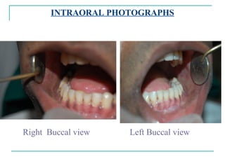 Long case osmf | PPT