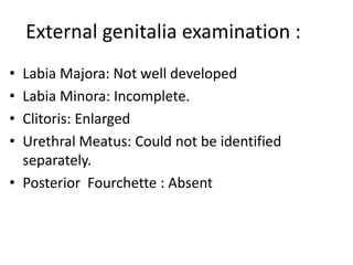 Long case presentation ( urogenital sinus ).pptx