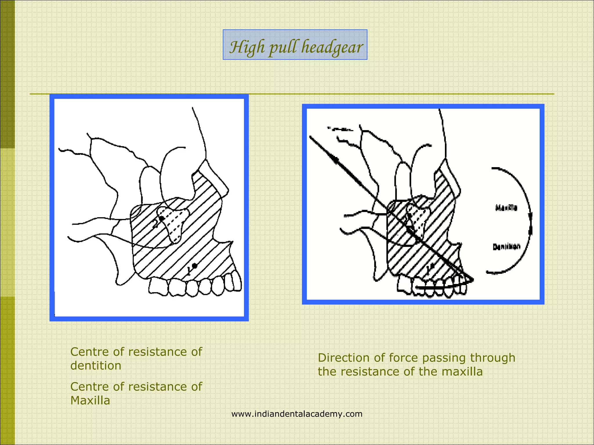 Long face syndrome | PPT