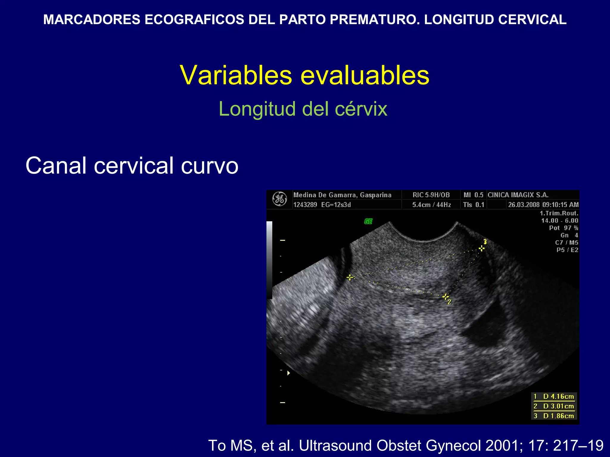 Longitud cervical, mas alla del cribado | PPT