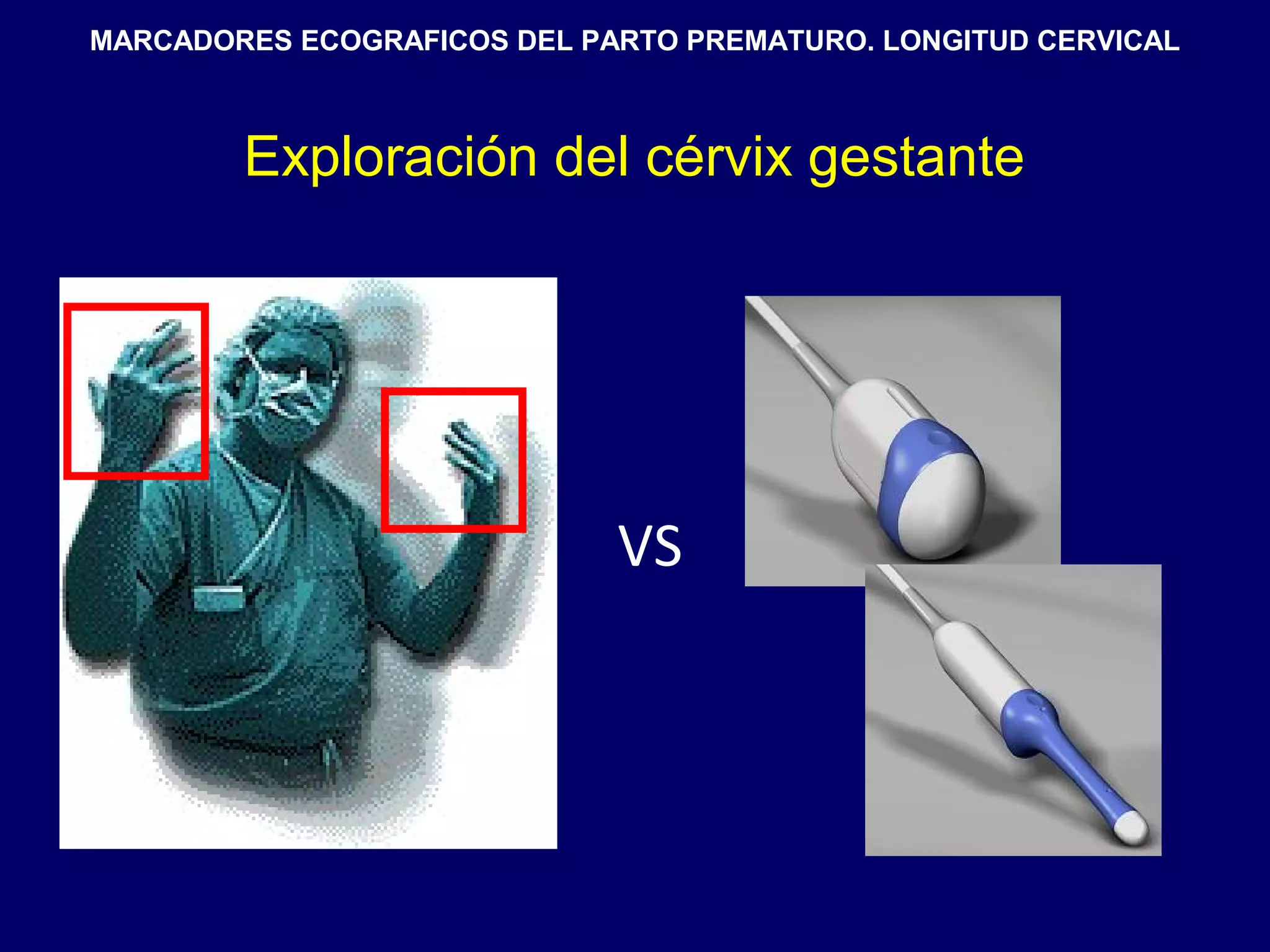 Longitud cervical, mas alla del cribado | PPT