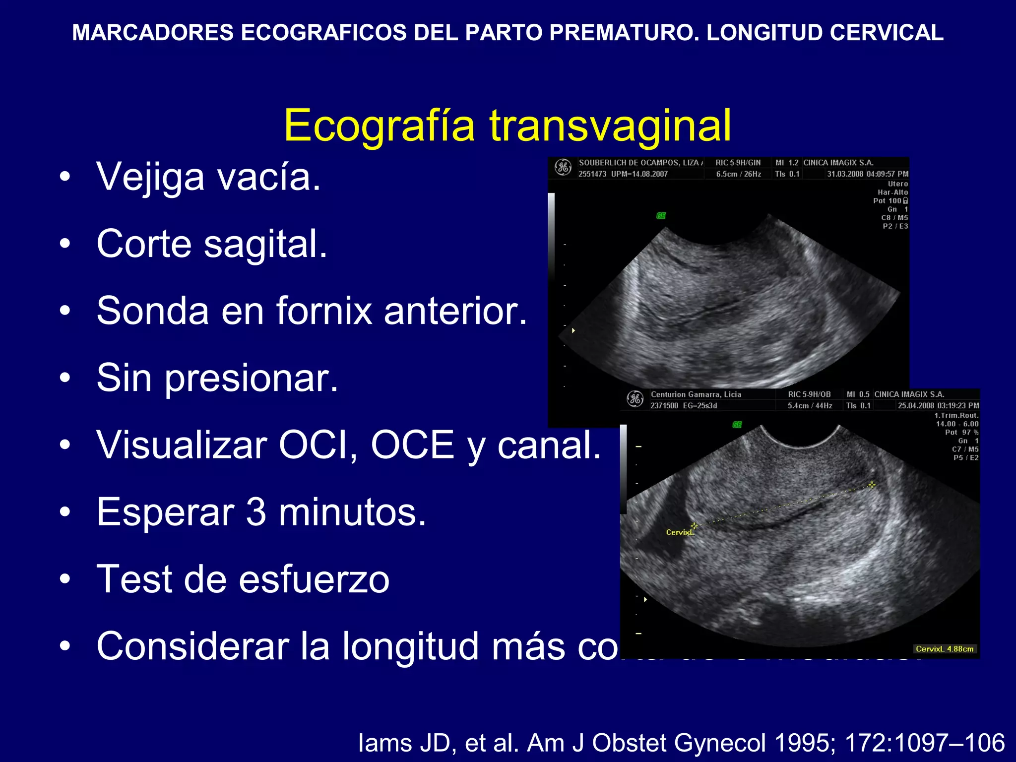 Longitud cervical, mas alla del cribado | PPT