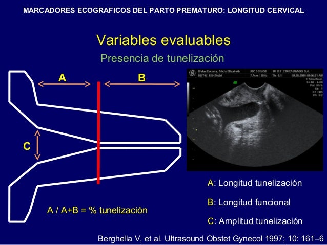Longitud cervical, mas alla del cribado