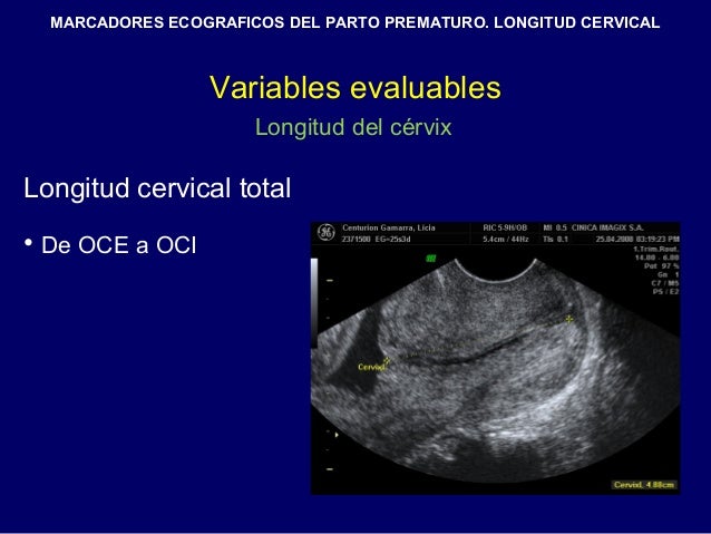 Longitud cervical, mas alla del cribado