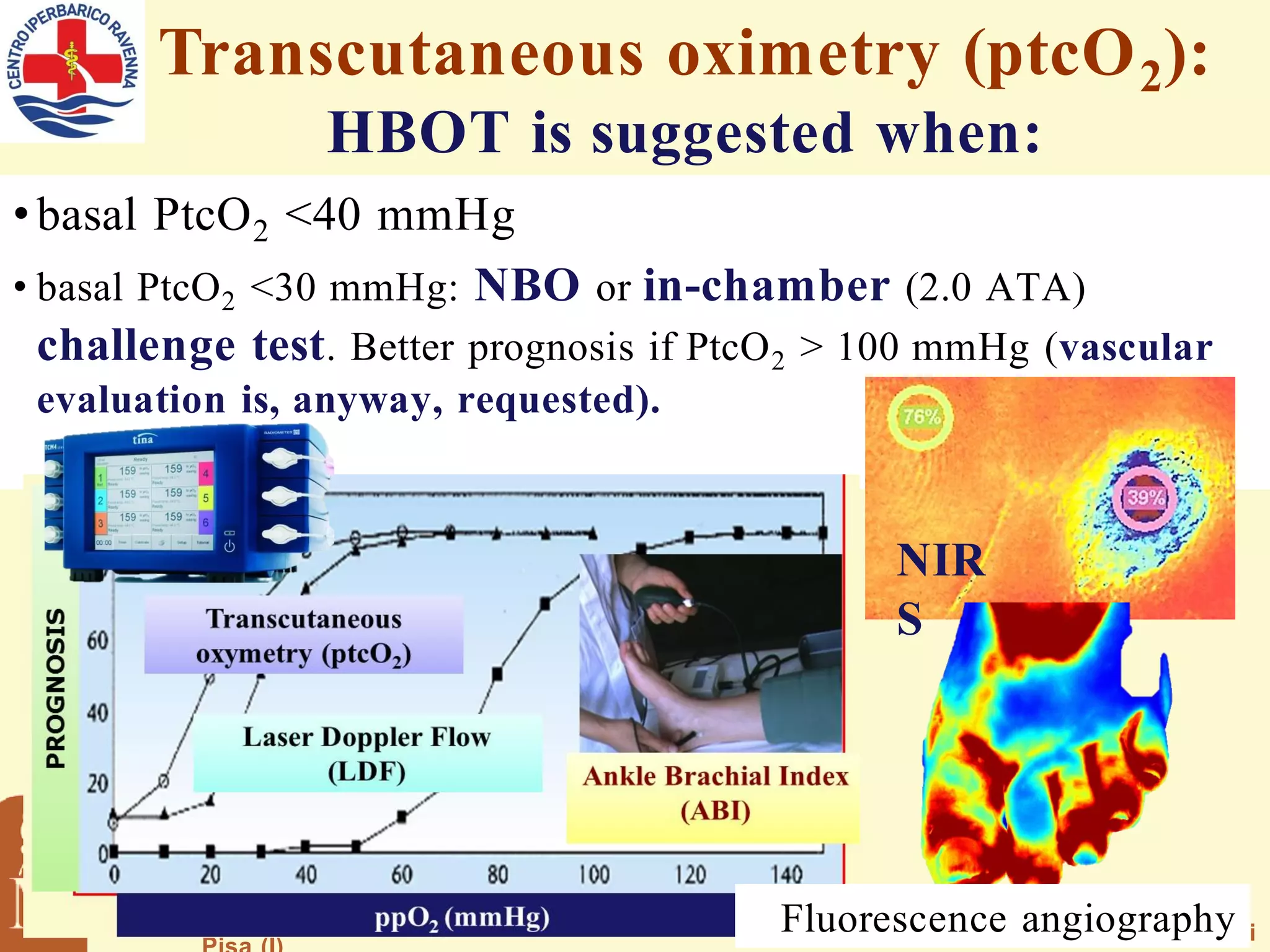 HBOT in Delayed Wound Healing and Diabetic Foot Ulcer | PPT