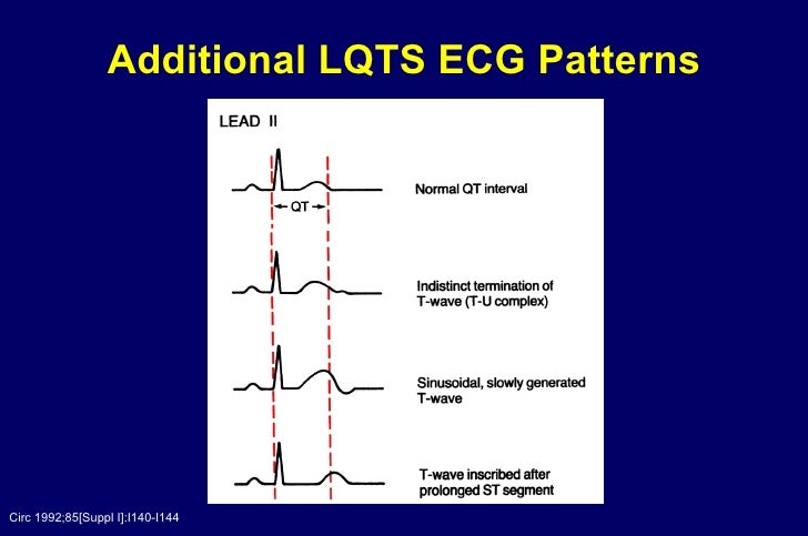 The Long QT Syndrome: Overview and Management The Long QT Syndrome:…