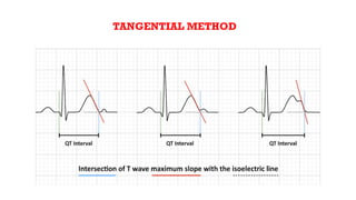 Long QT Syndromes from standard textbooks | PDF