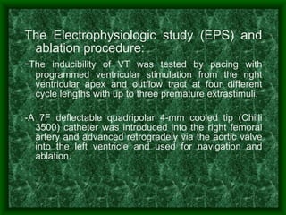 Long term post Ventricular tachycardia ablation guided by non contact ...
