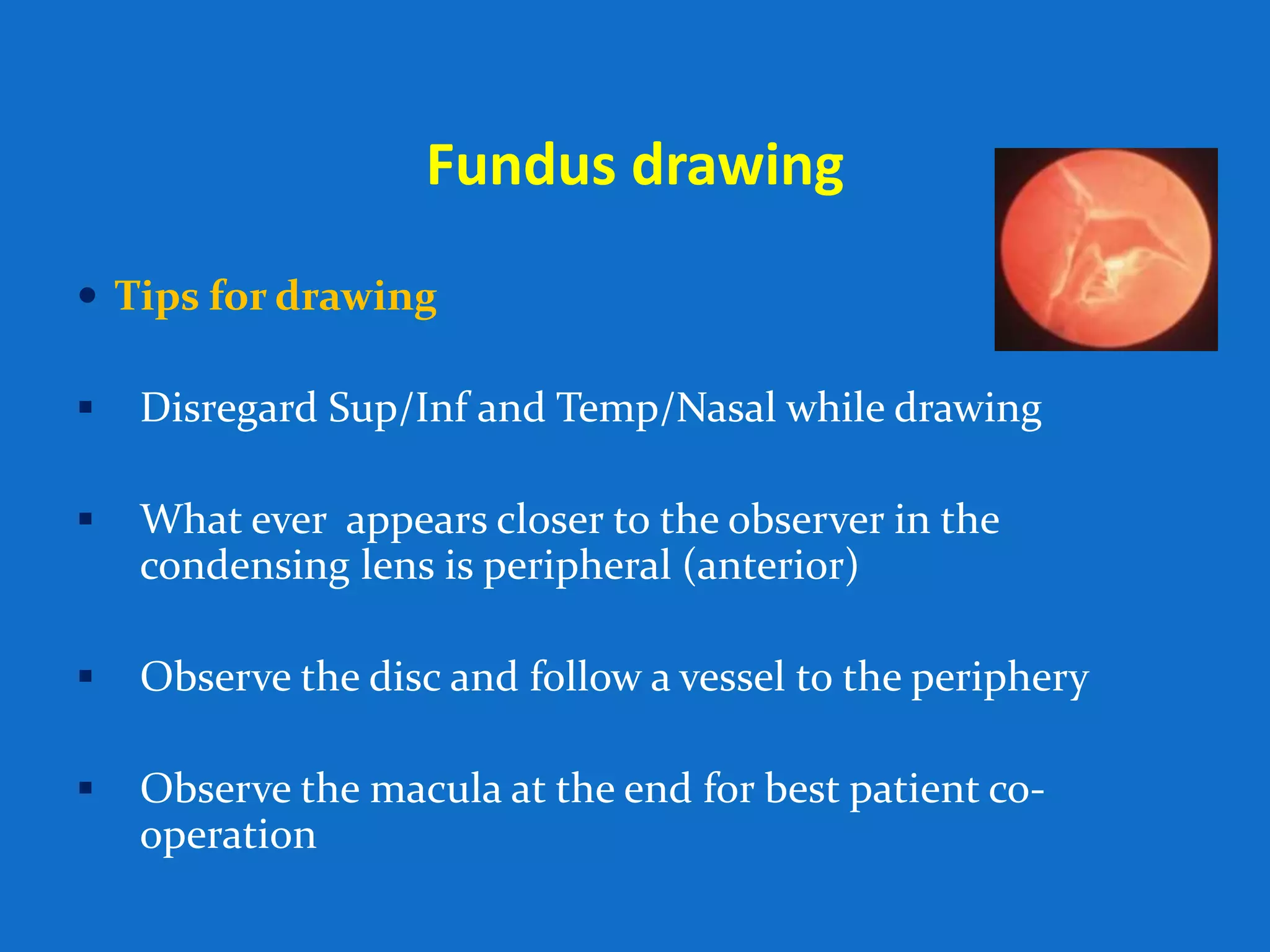 Looking deep into retina : indirect ophthalmoscopy and fundus drawing ...