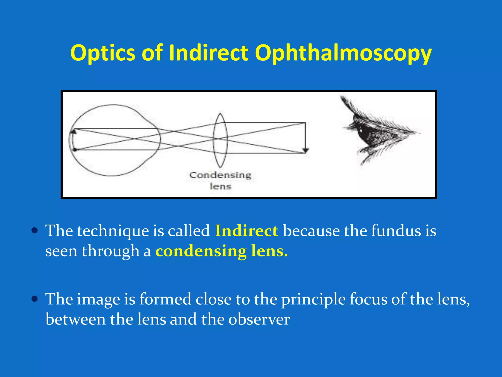 Looking deep into retina : indirect ophthalmoscopy and fundus drawing ...