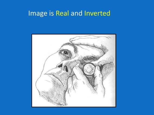 Looking deep into retina : indirect ophthalmoscopy and fundus drawing | PPT