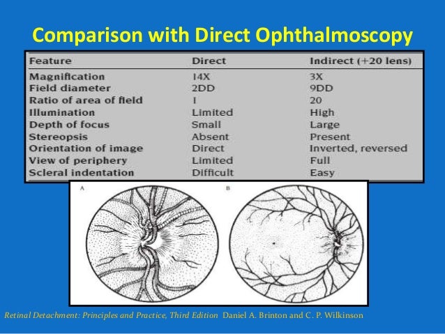 Looking deep into retina : indirect ophthalmoscopy and fundus drawing