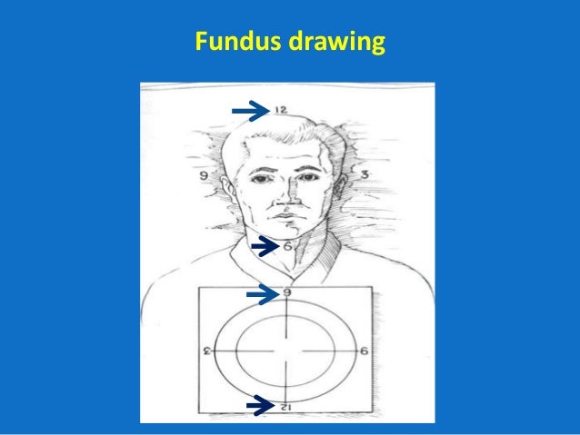 Looking deep into retina : indirect ophthalmoscopy and fundus drawing