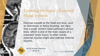 TBI Signs After a Crash | PPT