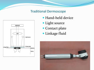 Looking through a Dermoscope | PPTX