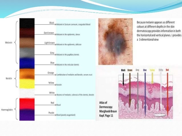 Looking through a Dermoscope