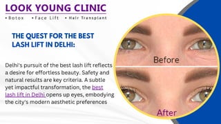 Transform Your Look with Expert Botox Treatment | PPT