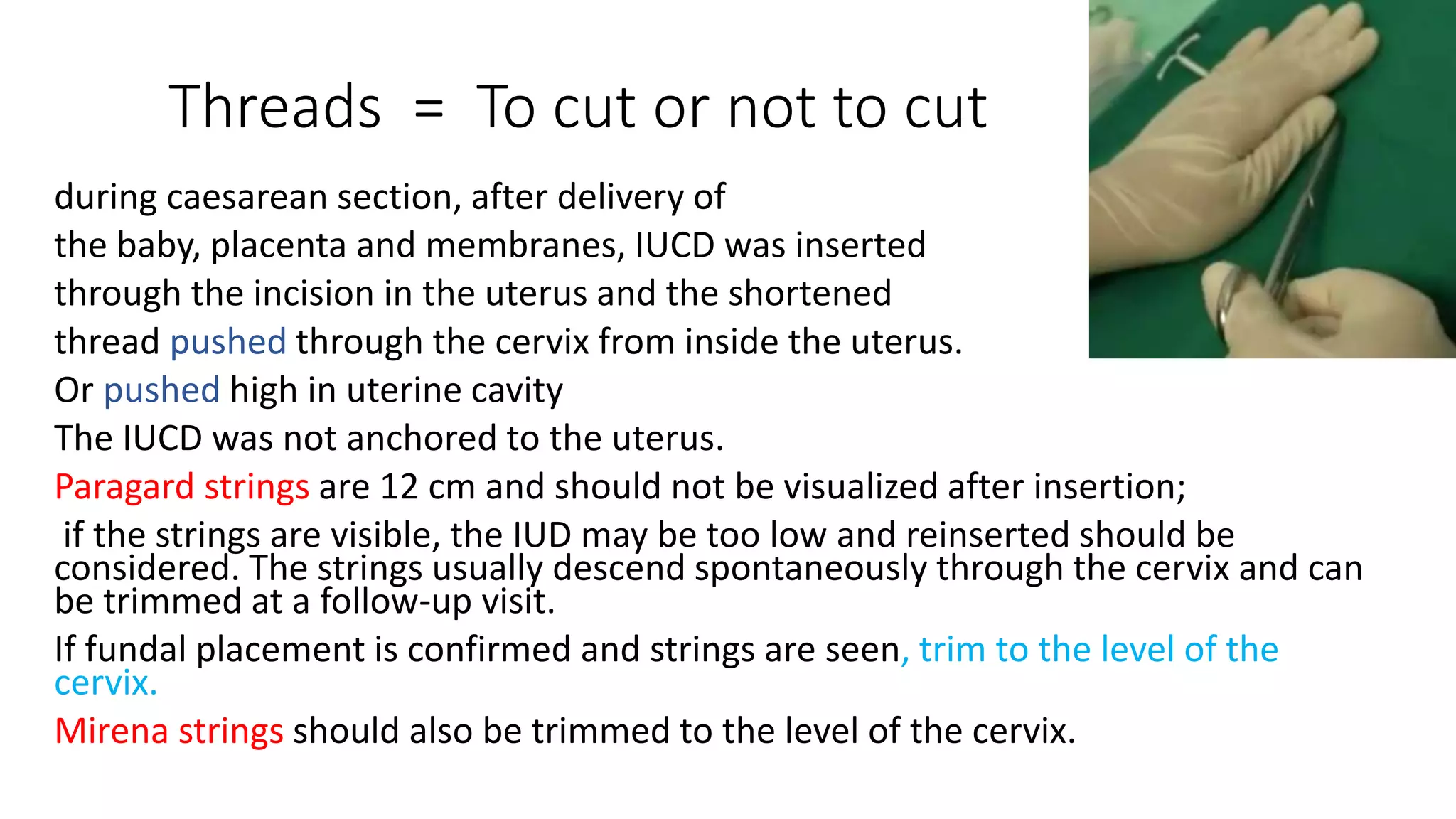 Loop (device orsystem) insertion during cesarean section | PPTX