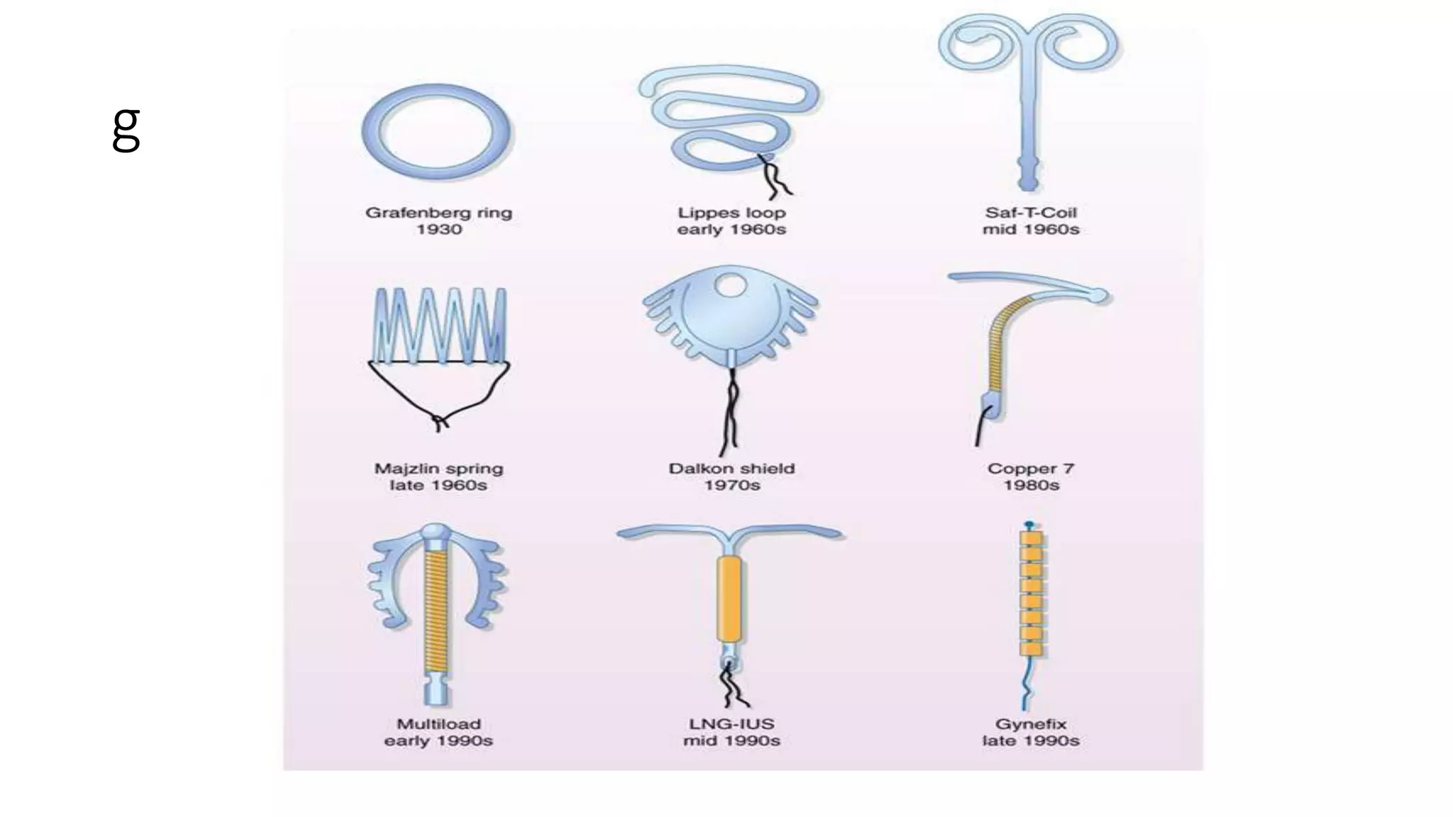 Loop (device orsystem) insertion during cesarean section | PPTX