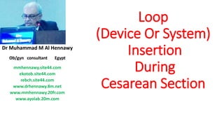 Loop (device orsystem) insertion during cesarean section | PPT