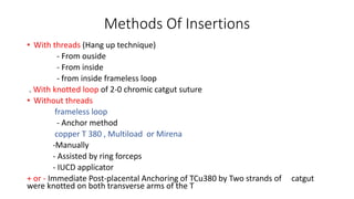Loop (device orsystem) insertion during cesarean section | PPT