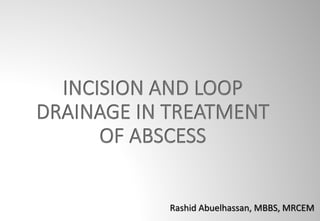 Loop drainage of Abscess | PPTX