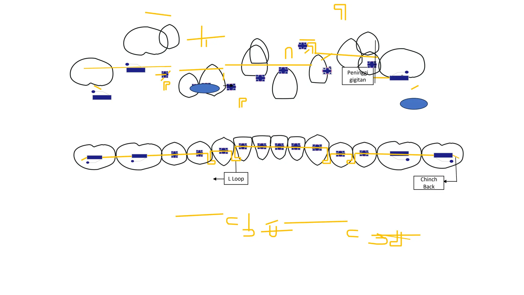 Loop edgewise Nadia untuk design ortodontik | PPTX