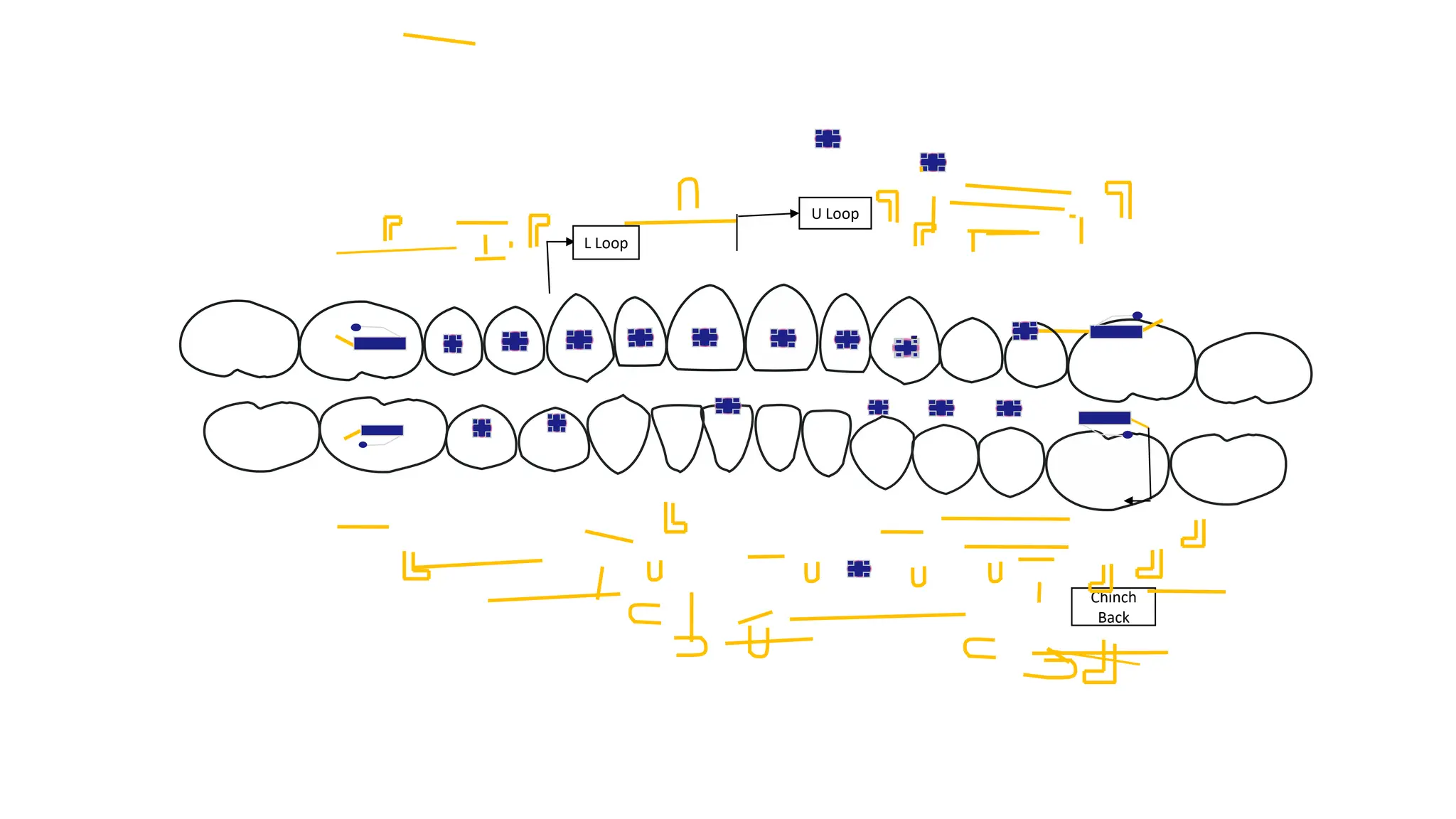 Loop edgewise Nadia untuk design ortodontik | PPTX