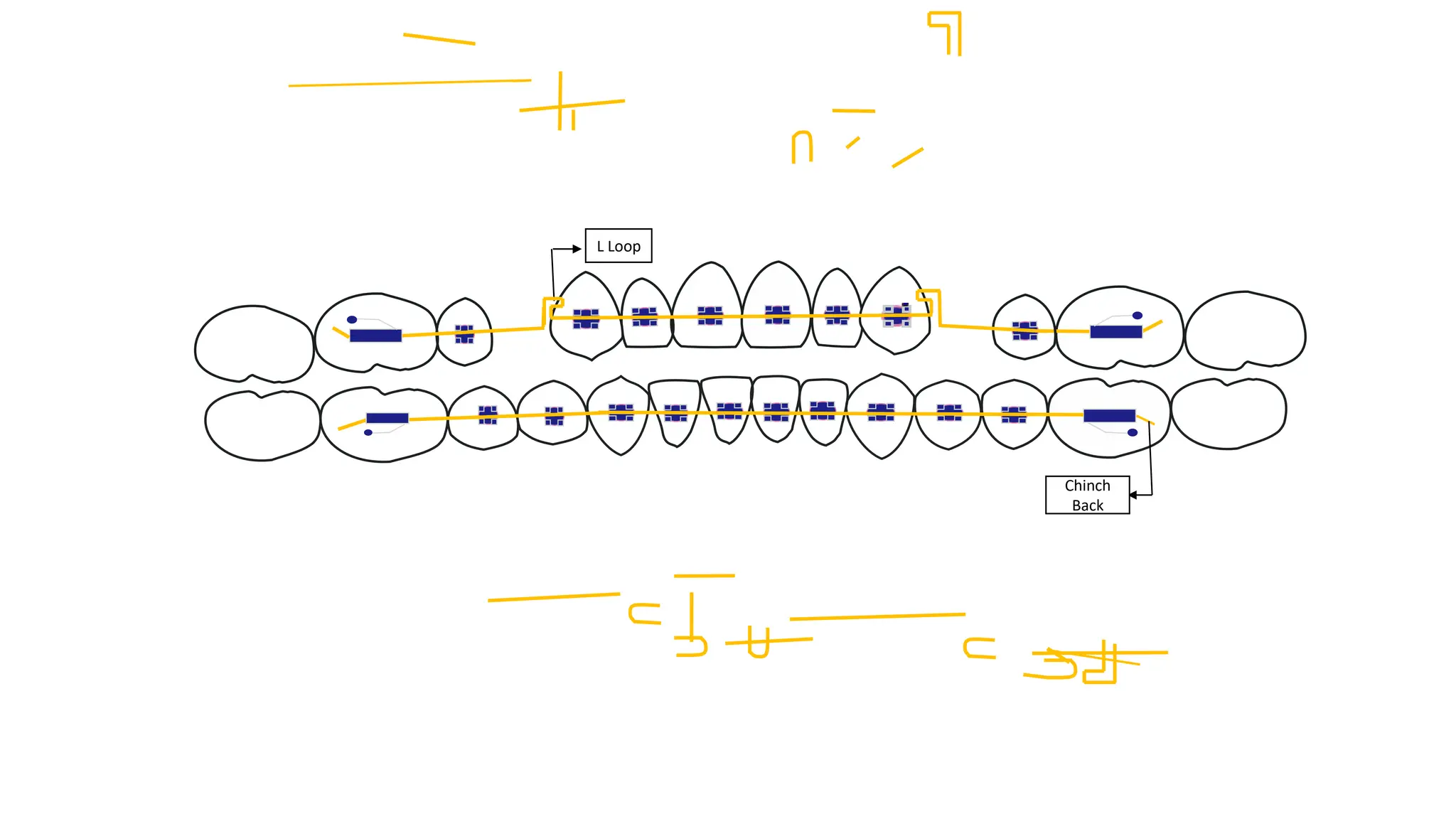 Loop edgewise Nadia untuk design ortodontik | PPTX