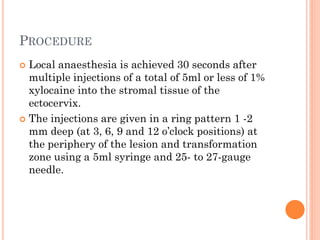 Loop electrosurgical excision procedure | PDF