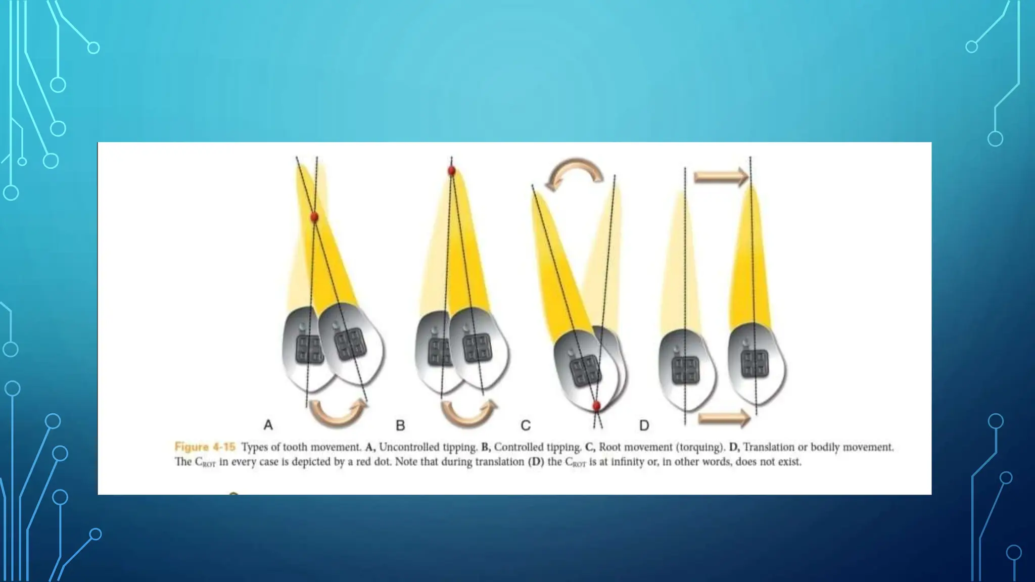 Loop mechanics by dr maryam ghazal in akhtar saeed dental college.pptx