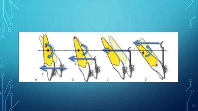 Loop mechanics by dr maryam ghazal in akhtar saeed dental college.pptx ...