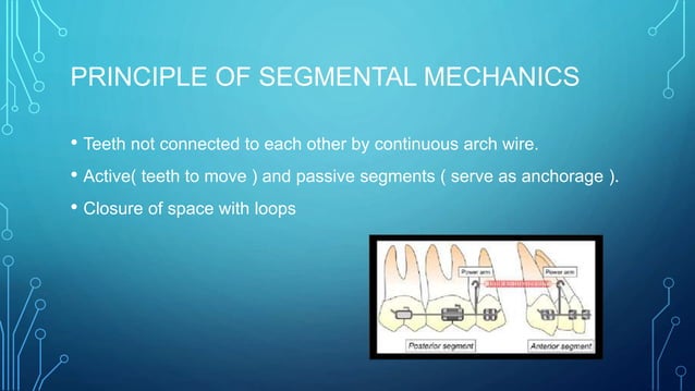 Loop mechanics by dr maryam ghazal in akhtar saeed dental college.pptx ...