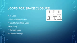 Loop mechanics by dr maryam ghazal in akhtar saeed dental college.pptx