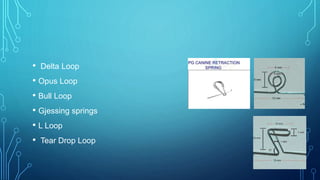 Loop mechanics by dr maryam ghazal in akhtar saeed dental college.pptx