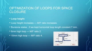 Loop mechanics by dr maryam ghazal in akhtar saeed dental college.pptx