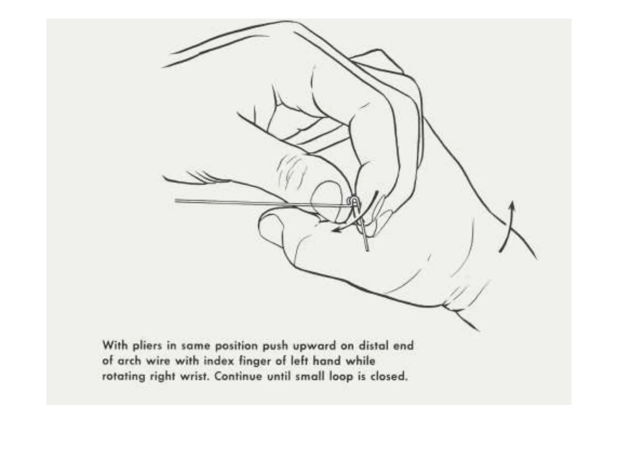 Loops In Orthodontics T Loop Bull Loop Vertical Loop Mushroom Loop Stop Loop Pptx Dental