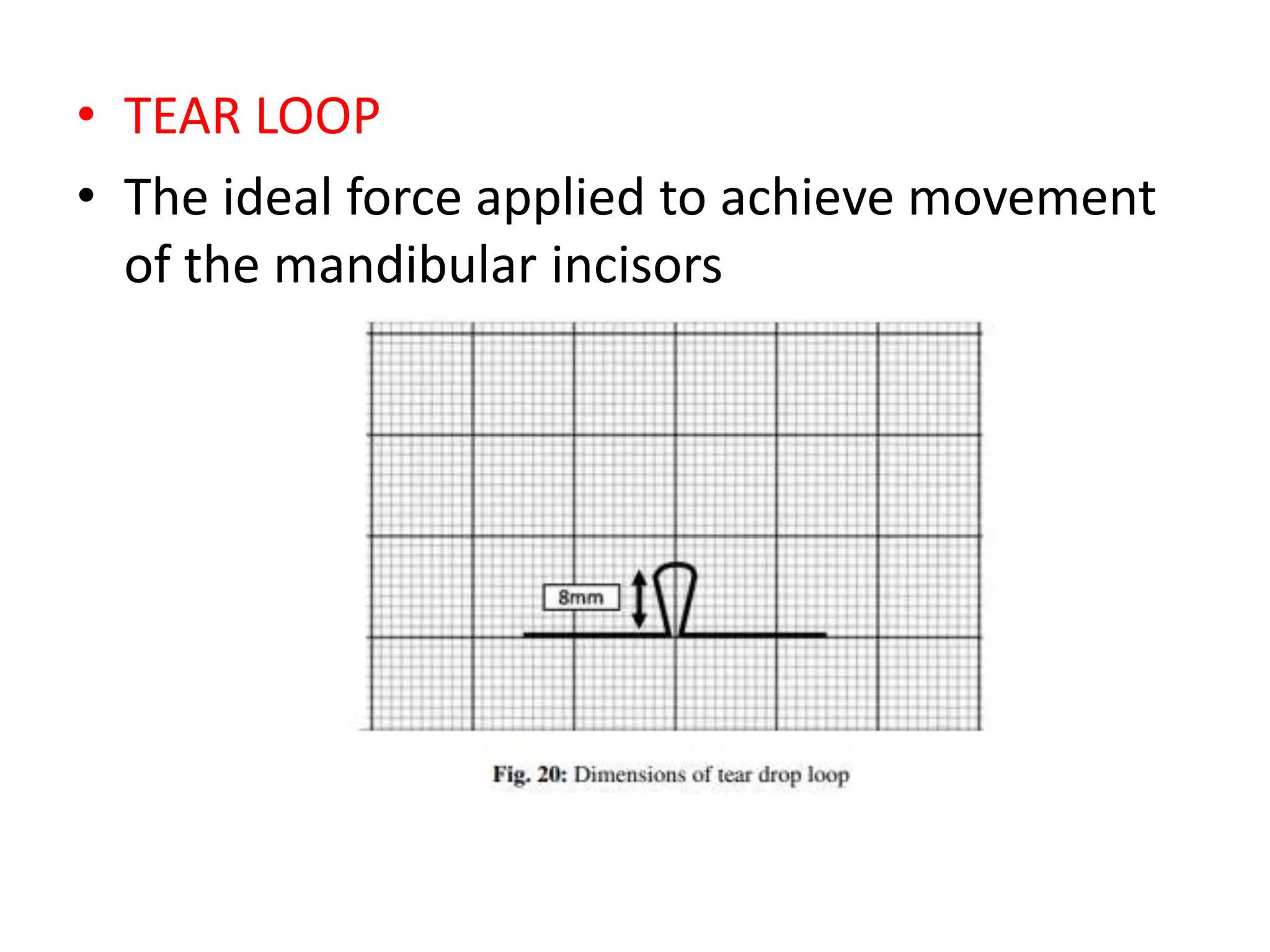 Loops In Orthodontics T Loop Bull Loop Vertical Loop Mushroom Loop Stop Loop Pptx Dental
