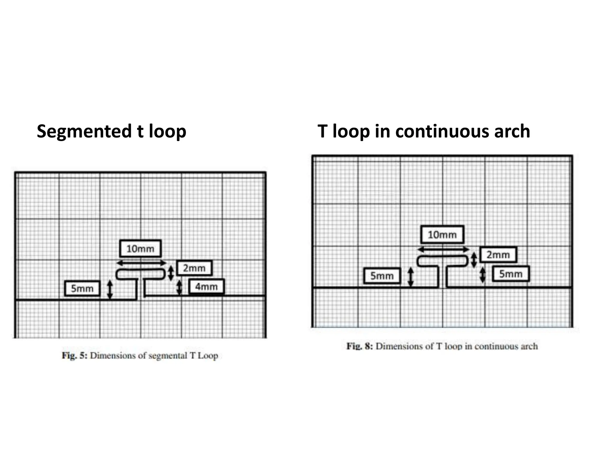 Loops In Orthodontics T Loop Bull Loop Vertical Loop Mushroom Loop Stop Loop Pptx Dental