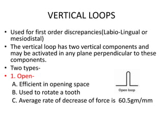 LOOPS in orthodontics t loop bull loop vertical loop mushroom loop stop ...
