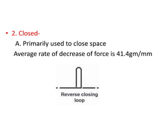 LOOPS in orthodontics t loop bull loop vertical loop mushroom loop stop ...