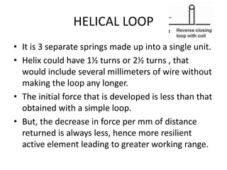 LOOPS in orthodontics t loop bull loop vertical loop mushroom loop stop ...
