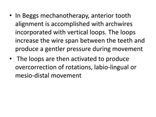 LOOPS in orthodontics t loop bull loop vertical loop mushroom loop stop ...